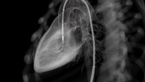 Hybrid Home Page | Hybrid Medical Animation